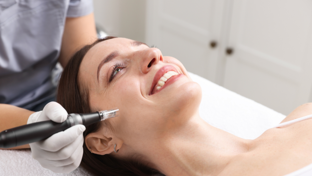 Microneedling Treatments - New Vision Med Spa